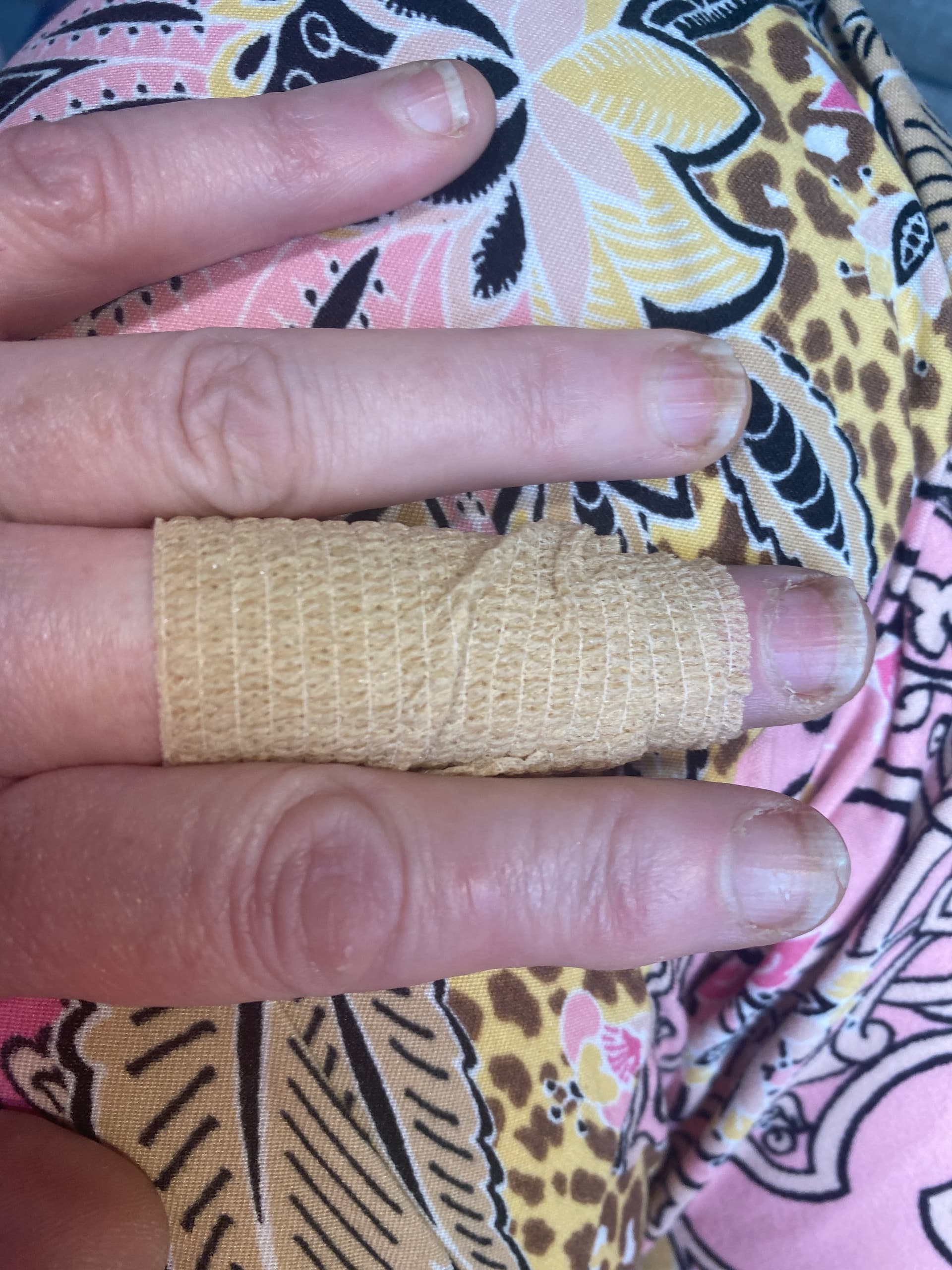 Middle Finger, middle joint swells at night and hurts. - Crochet 🧶 ...